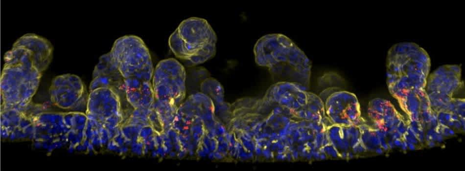 FindAPhD : 15 Fully Funded PhD Positions: StraDiVarious – Strains ...